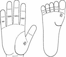 SEMINTOTERAPIA referat