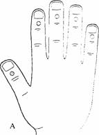 SEMINTOTERAPIA referat